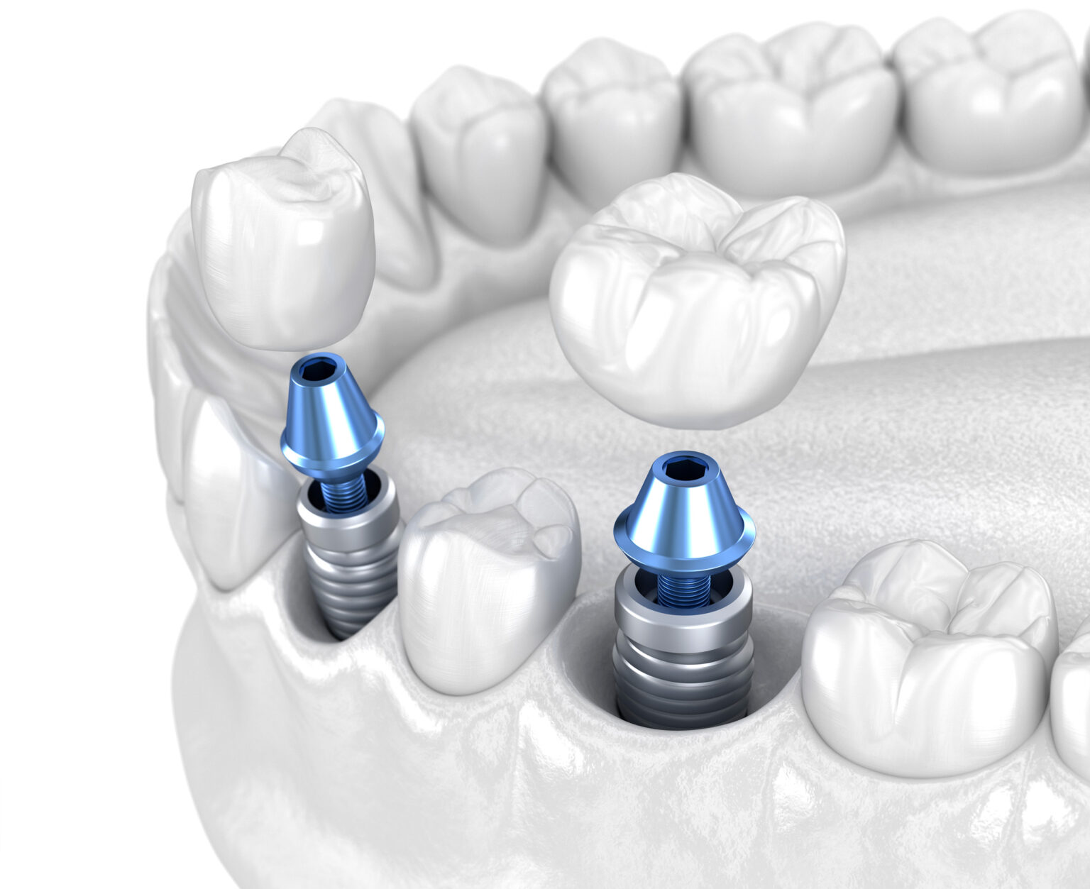 Stoller Dental Laboratory