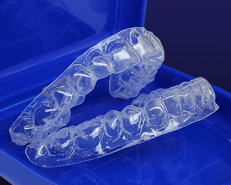 Bleaching Trays - Stoller Dental Lab