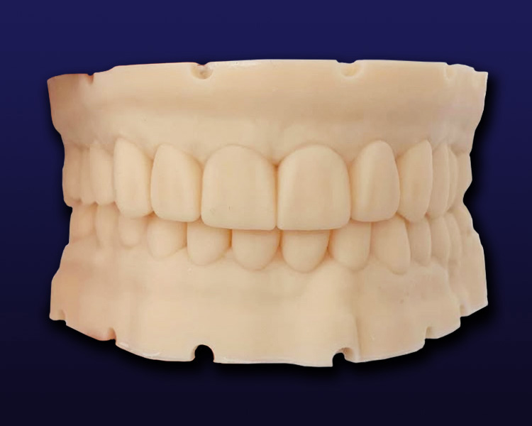Digital Diagnostics - Stoller Dental Lab