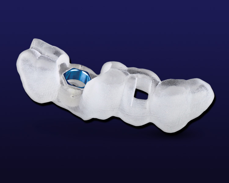 Surgical Guides - Stoller Dental Lab