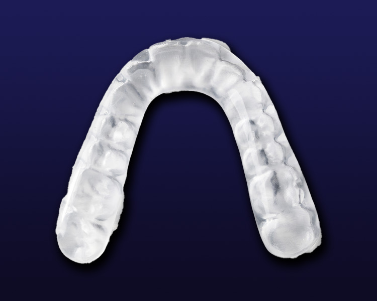 Nightguards/Splints - Stoller Dental Lab